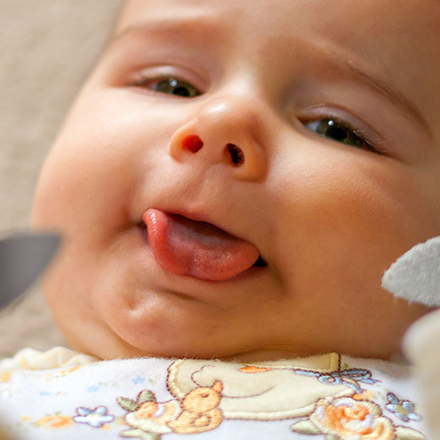 Lip and Tongue Ties: A Guide for Parents – Saint Paul MN | Franco ...
